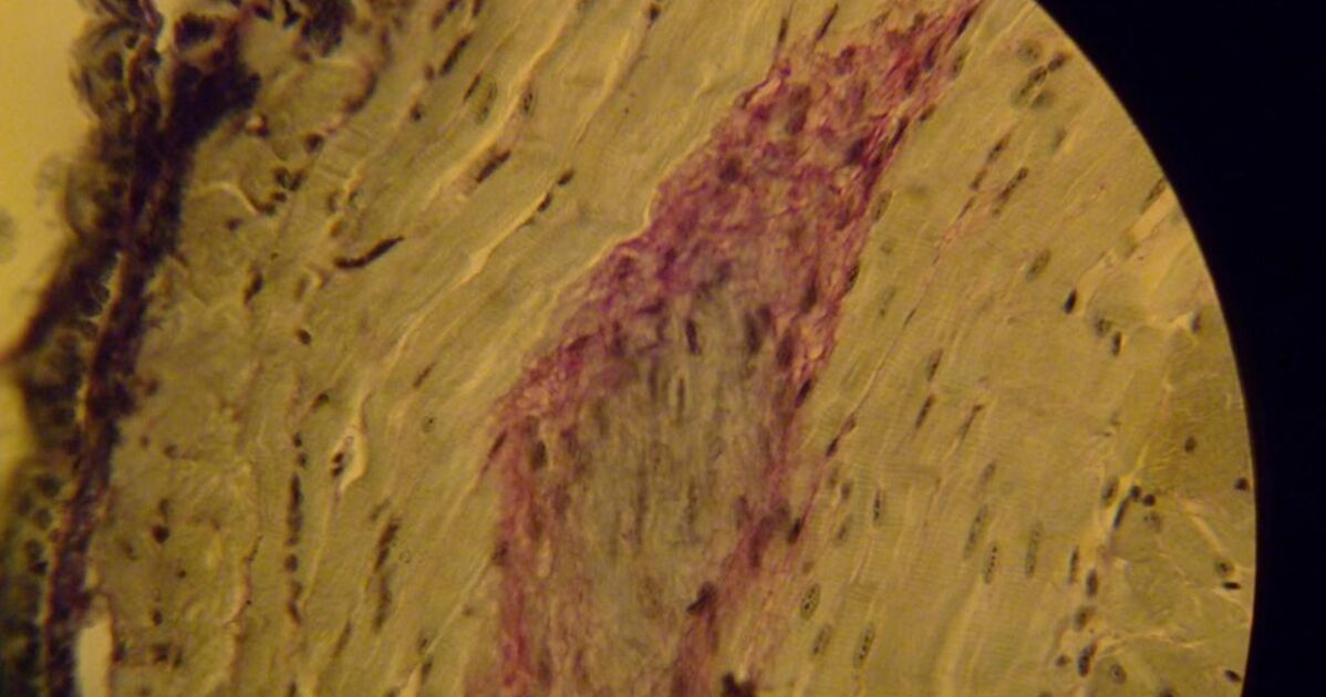 cellules_musculaires_au_microscope.JPG, une serie1 - Geo.fr